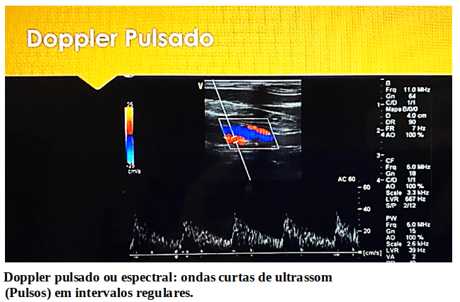 Ultrassonografia Doppler – Clinica Lambertucci